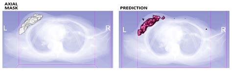Mathematics Free Full Text A Convolutional Neural Network Based Auto Segmentation Pipeline