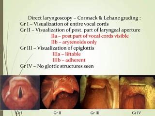 1092endotracheal Intubationpptx