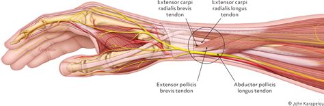 Injections Of The Hand And Wrist Part Ii Carpal Tunnel Syndrome