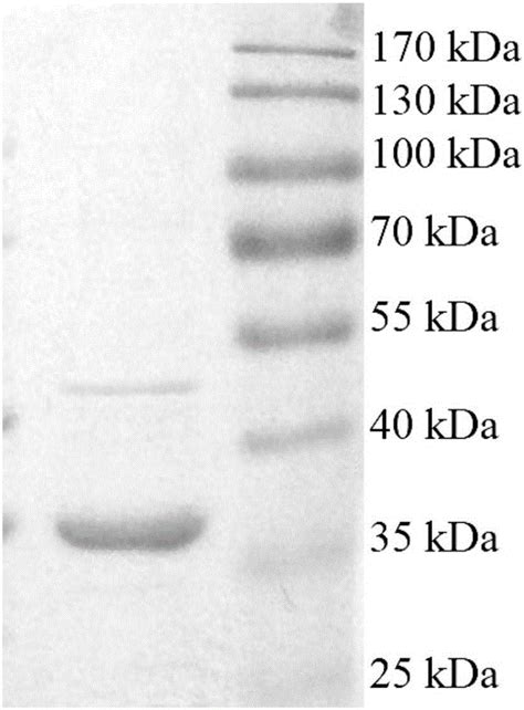 Deep Sea Sediment Sourced Esterase Est4 As Well As Encoding Gene And