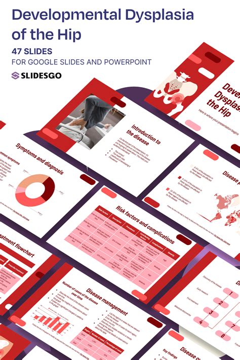 Developmental Dysplasia Of The Hip Presentation Template