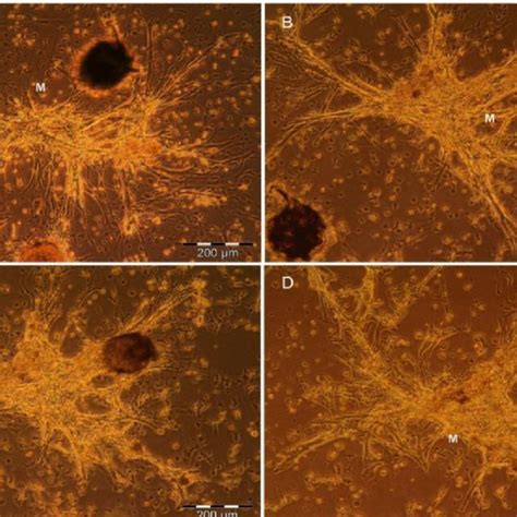 Epithelial Like And Spindle Like Cell Population In Culture Confluent Download Scientific