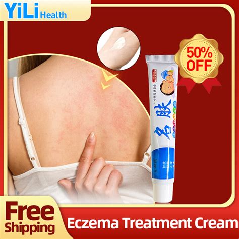 Eczema Treatment Cream Psoriasis Dermatitis Skin Herbal Ointment