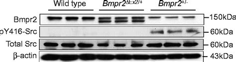 Bmpr2 Mutations And Endothelial Dysfunction In Pulmonary Arterial
