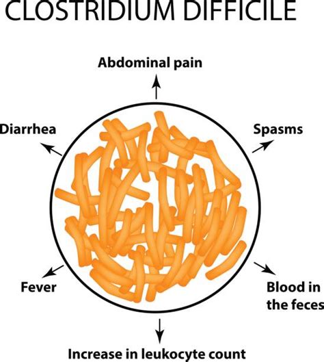 10 Difficile Bacteria Stock Illustrations Royalty Free Vector