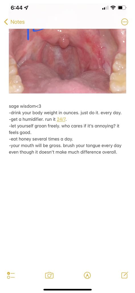 Tonsillectomy Healing Stages