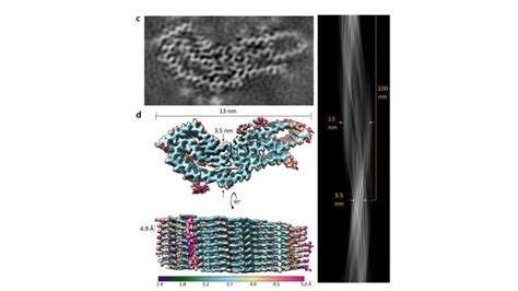 Alexander Peden On Linkedin The Structure Of An Infectious Prion