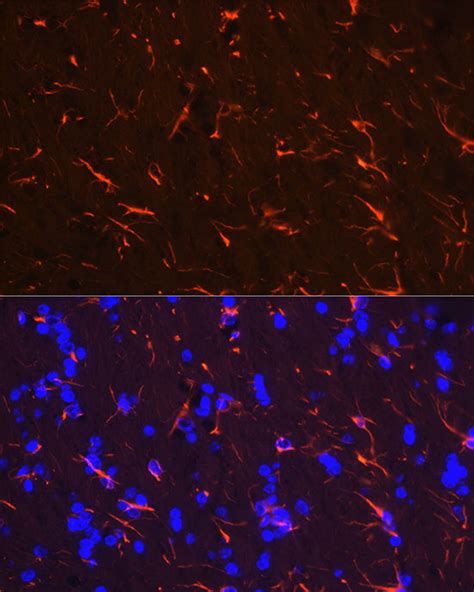 All Cell Type Marker Antibodies Research Areas Abclonal