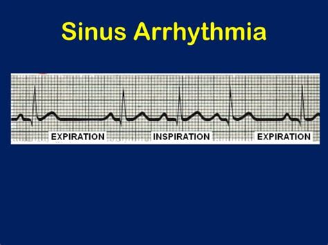 Autonomic Function Tests Ppt Lung And Respiratory Health Diseases