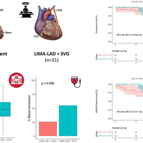 Outcomes After Lima‐lad With Stent Versus Lima‐lad With Svg A Download Scientific Diagram