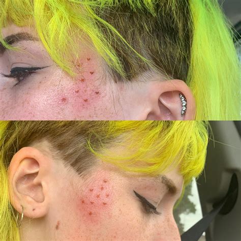 Freckle Surprises Done By Tattsforbrats Melbourne Vic Aus Cute