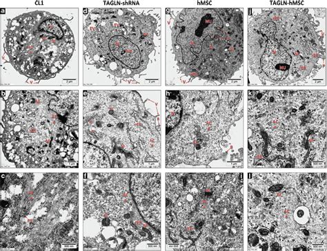 Transmission Electron Microscopy Tem Analysis Ultra Thin Sections Download Scientific