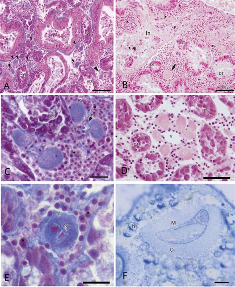 Unidentified Parasitic Ciliates In The Interstitium Of The Digestive