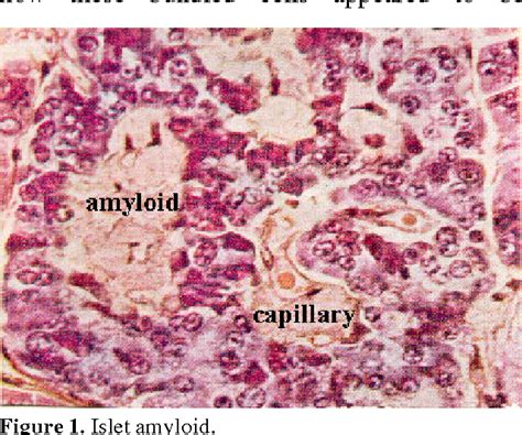 Figure 1 From A Is For Amylin And Amyloid In Type 2 Diabetes Mellitus