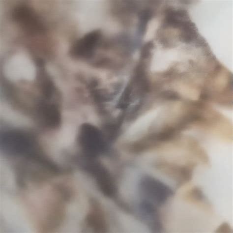 Severe Multiple Sclerosis Treatment An In Depth Analysis