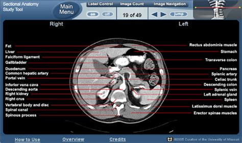 Sectional Anatomy For Imaging Professionals Workbook For Sectional