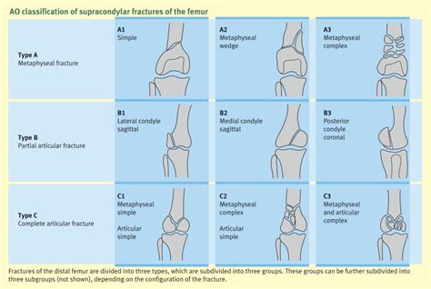 Fractures And Dislocations Around The Knee Surgery Oxford