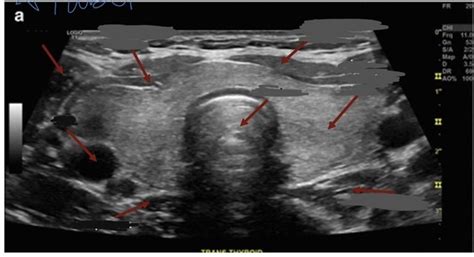 Thyroid Exam Review Diagram Quizlet