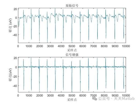 【胎心监护仪】基于快速独立成分分析fastica实现胎儿心跳信号噪声消除附matlab代码fastica 排序 Csdn博客
