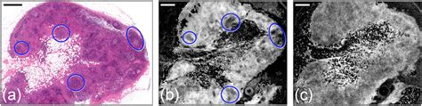 parametric imaging of cancer with optical coherence tomography obel