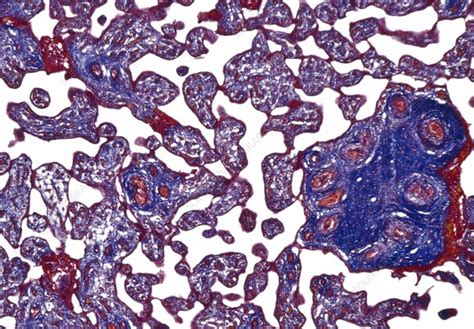 Placenta Light Micrograph Stock Image P6160535 Science Photo