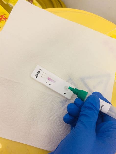 Amniosure Testi Amniyon Sıvısı 👩🏻‍⚕️ayşebe