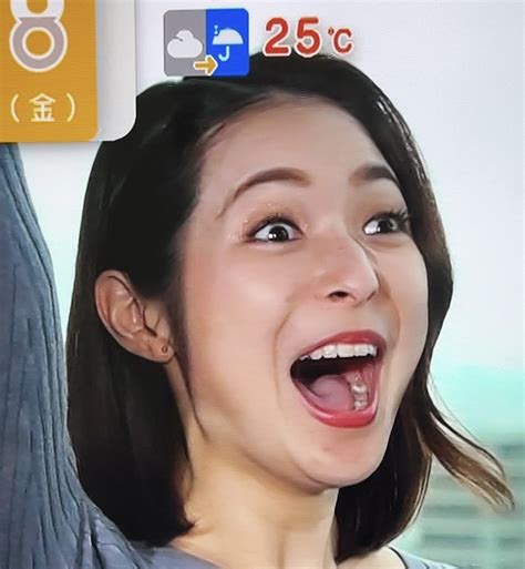 記事no179：画像3 大口開けた女性の画像素人・女優・アナウンサー 素人 掲示板 いつもちゃんねる