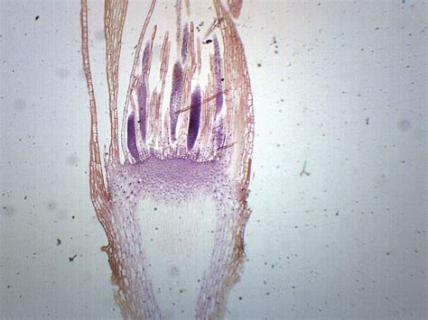 Moss Archegonial Head
