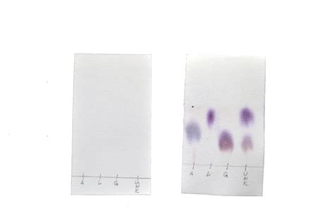 Ninhydrin Paper Chromatography Of Amino Acids At Nicholas Flower Blog
