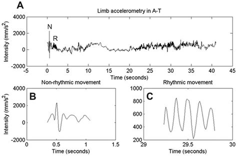 Accelerometry From One A T Subject During Postural Condition Composite