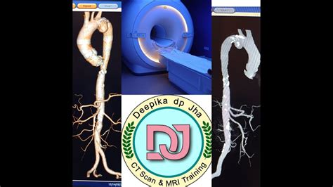 Ct Aortogram Planning And Processing In Philips 128 Slice Youtube