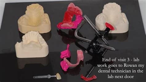 Finlays Newsletter 60 Sylvias Upper Kennedy Class 2 Mod 1 Metal Based