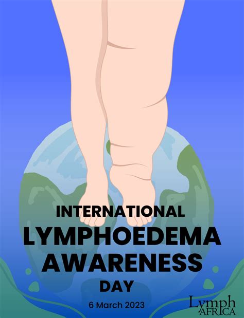 Anne Berzen Posted On Linkedin