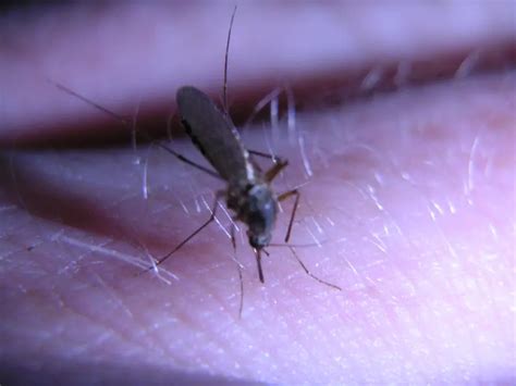 Why Do Mosquito Bites Itch 11 Tips To Stop Scratching