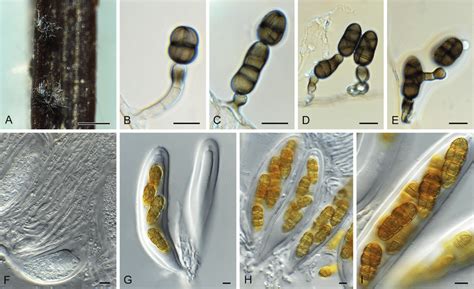 Stemphylium Eturmiunum Cpc 38613 A Ascomata Developing On Pna B E