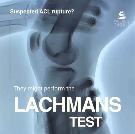 The Acl And How We Test It