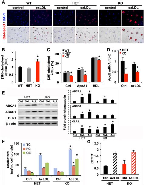 Interferon Regulatory Factor Binding Protein 2 Irf2bp2 Deficient Bone