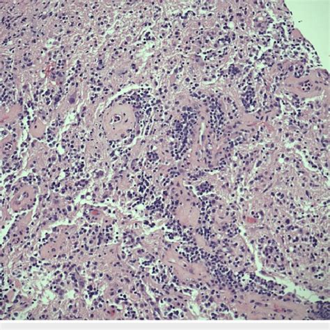Cells Positive For Cd20 Immunostain Download Scientific Diagram