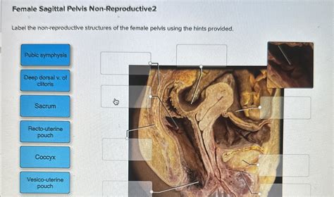 Solved Female Sagittal Pelvis Non Reproductive2label The