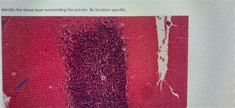 identify the tissue layer surrounding the pointer be