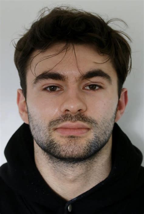 Is This Midline Discrepancy And Eye Asymmetry Still Fixable At 24 R Orthotropics