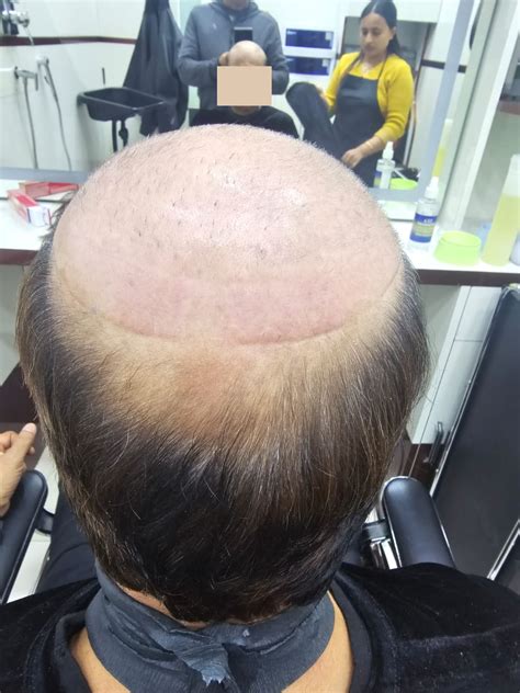 General Re Attachment Sytem K Hair Nepal