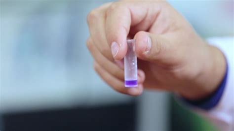 Lab Vial With Purple Liquid In Scientist Hand Science Laboratory