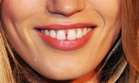 Gap Between Teeth A Sign Of Good Luck Or Bad Luck