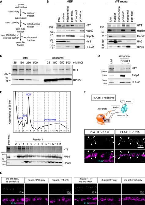 Customization Of The Translational Complex Regulates Mrna Specific Translation To Control Cns