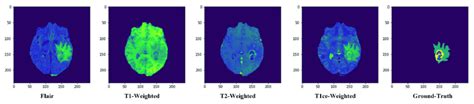 Deep Learning Hybrid Techniques For Brain Tumor Segmentation