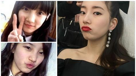 Bae Suzy Plastic Surgery Is She All Natural Or Not