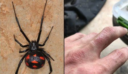 How Dangerous Are Black Widow Spiders