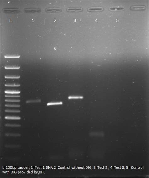 Labeling Of Southern Probe By Dig Pcr Researchgate