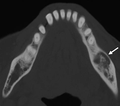 Dental Anatomy And Pathology Encountered On Routine Ct Of The Head And